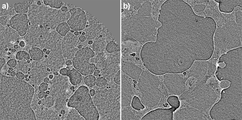 ice cream under microscope
