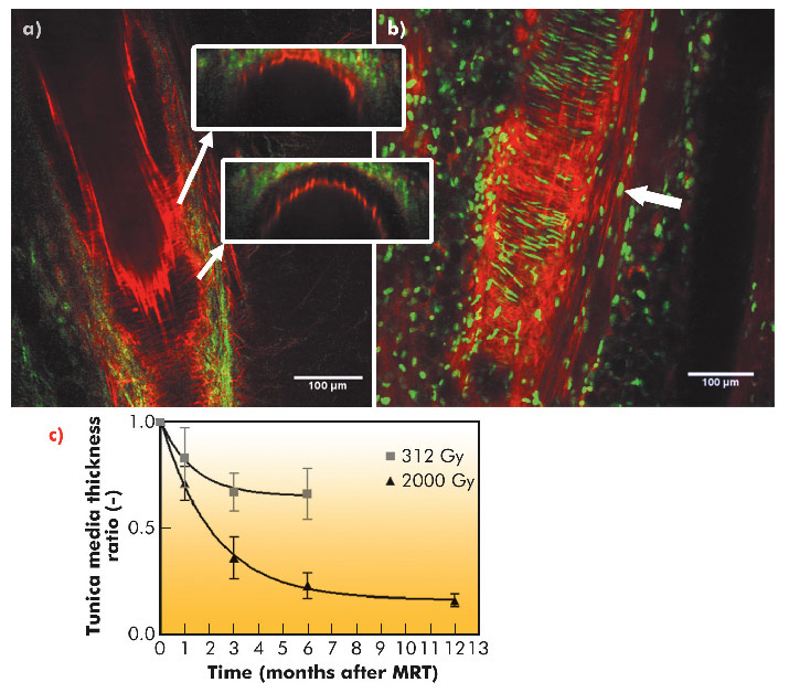 Tolerance of arteries to microplanar X-ray beams