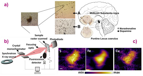 X-rays reveal the important role of copper in Parkinson’s disease
