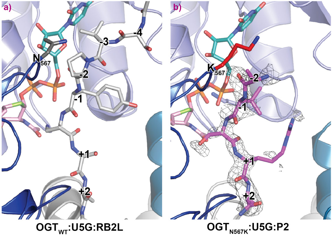 X-linked intellectual disability related to a mutation in the catalytic ...