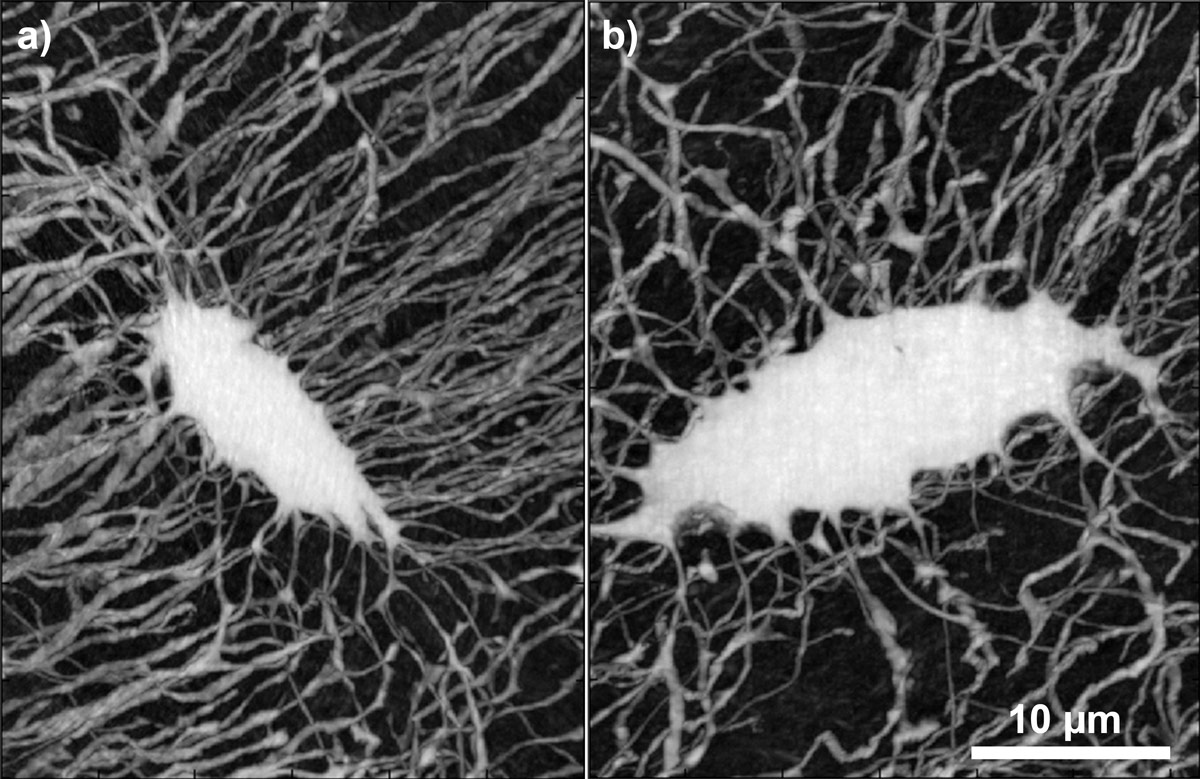 Bone tissue mass density is determined by the canalicular network ...